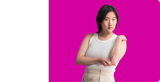 SOTYKTU 360 SUPPORT Patient Support Program - SOTYKTU® (deucravacitinib)